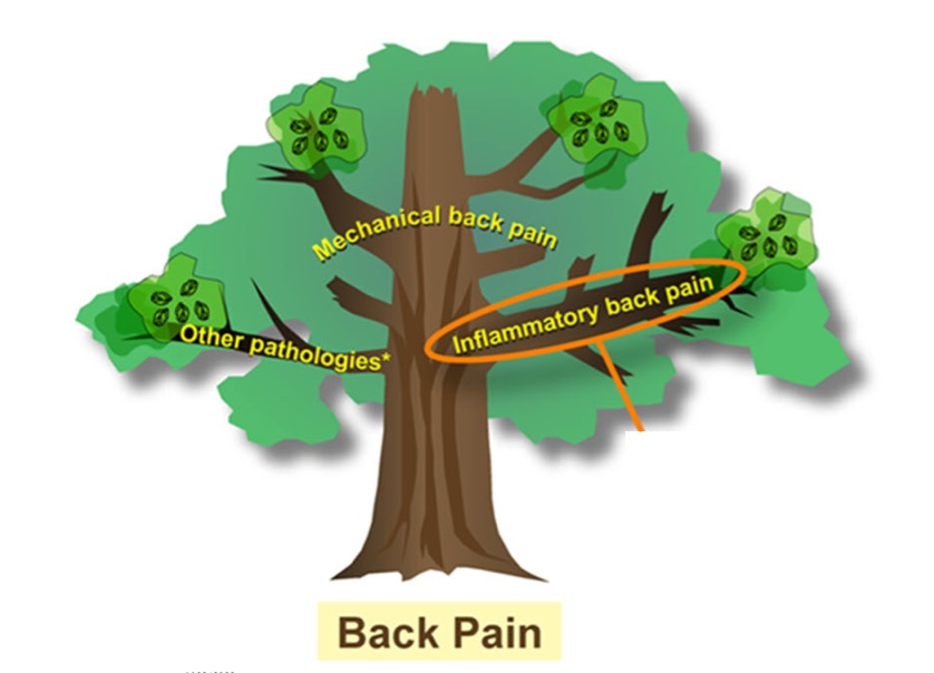 Using Tree Branches to understand Inflammatory Back Pain
